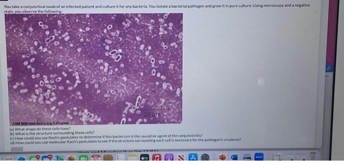 Solved You take a conjunctival swab of an infected patient | Chegg.com