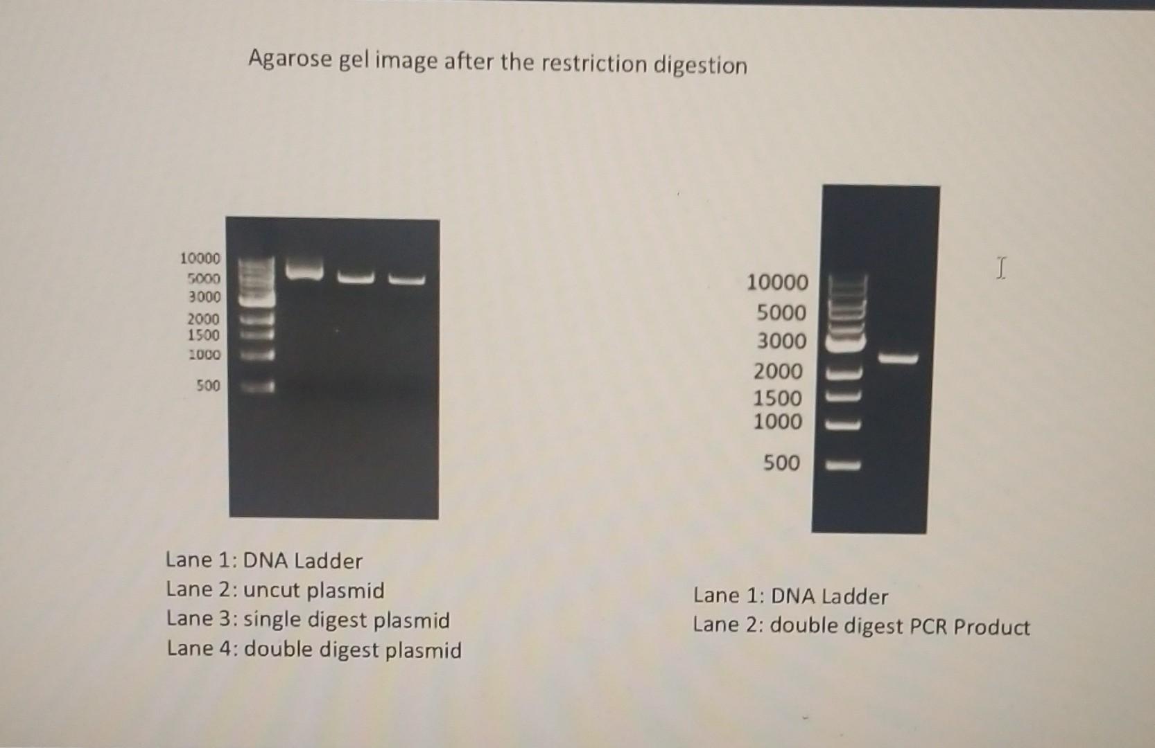 Solved Agarose gel image after the restriction digestion | Chegg.com