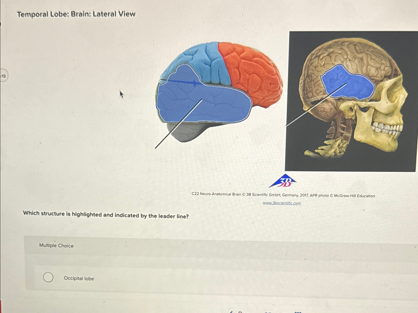 Solved Temporal Lobe: Brain: Lateral View12C22 | Chegg.com