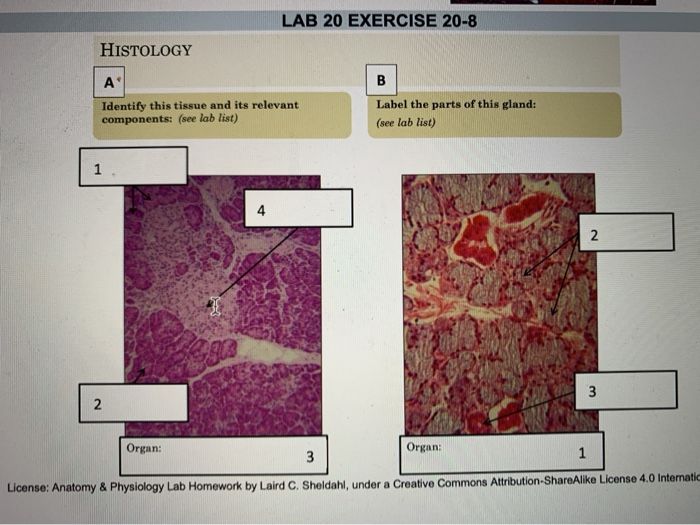 Solved LAB 20 EXERCISE 20-8 HISTOLOGY A Identify this tissue | Chegg.com