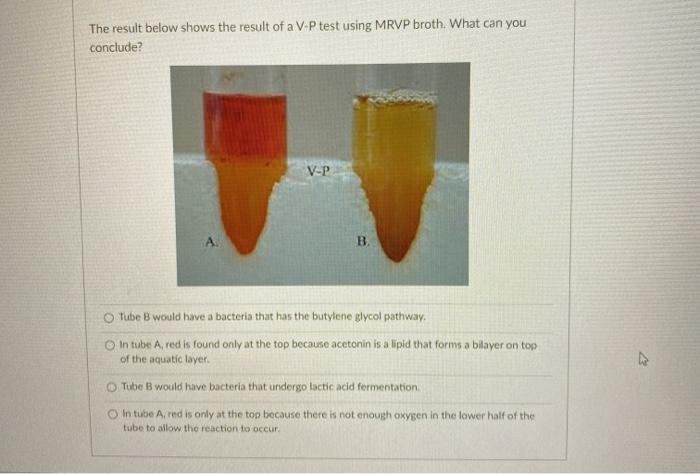 Solved The result below shows the result of a V.P test using | Chegg.com