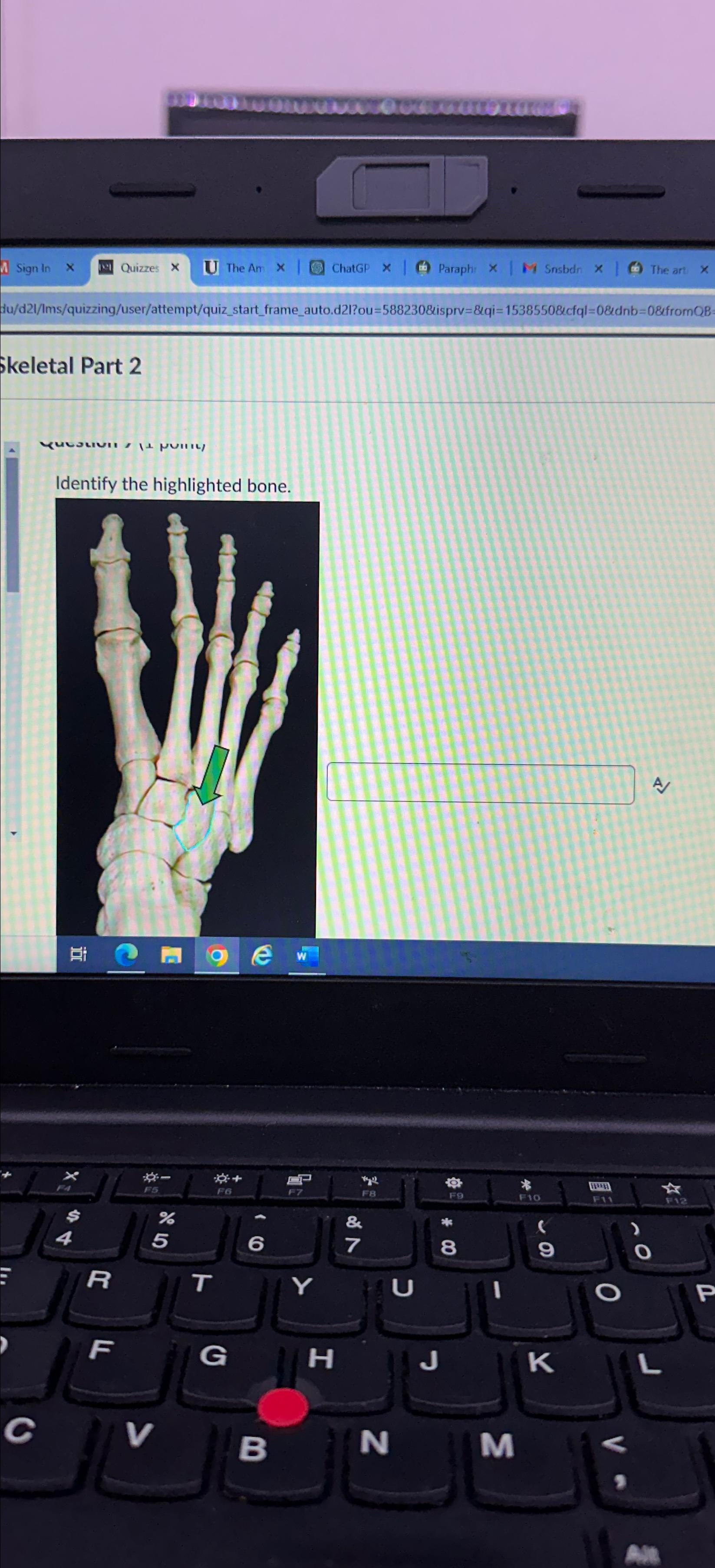 Solved keletal Part 2Identify the highlighted bone. | Chegg.com