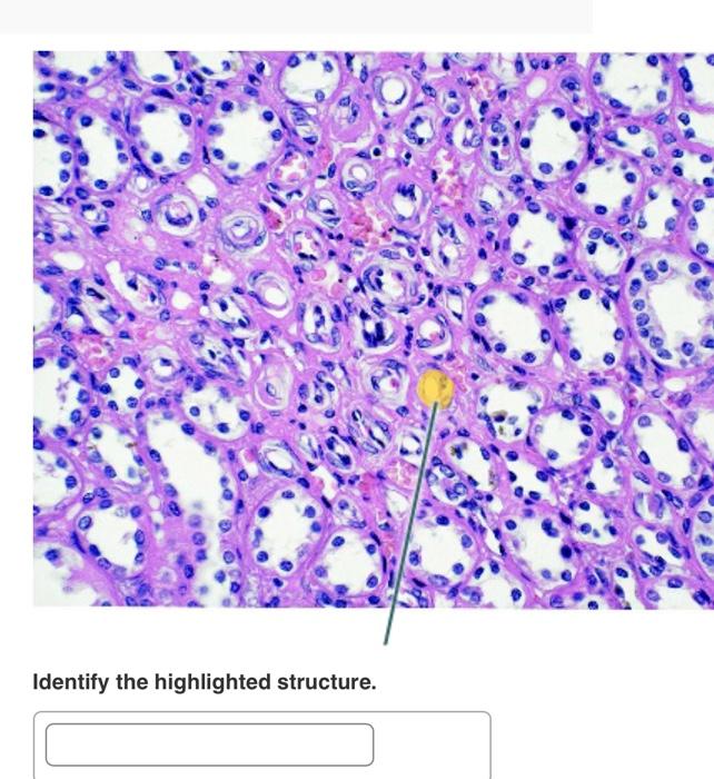 Solved Identify the highlighted structure.Identify the | Chegg.com