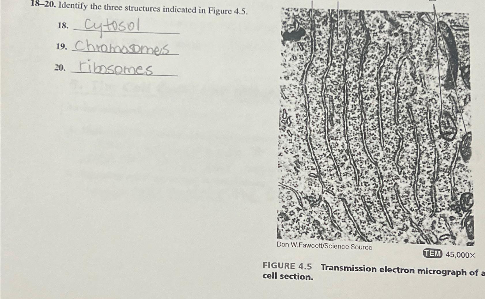 Solved 18-20. ﻿Identify the three structures indicated in | Chegg.com