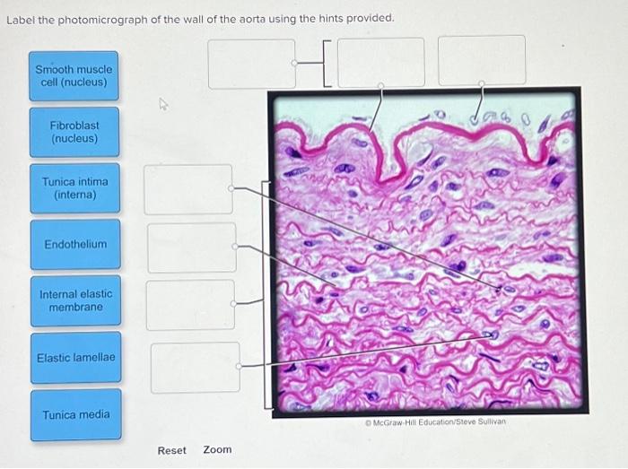 Solved Label the photomicrograph of the wall of the aorta | Chegg.com