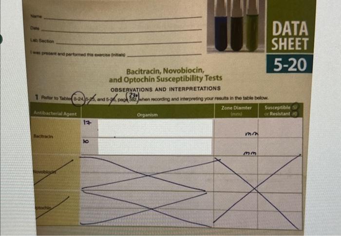 Solved Bacitracin, Novobiocin, and Optochin Susceptibility | Chegg.com