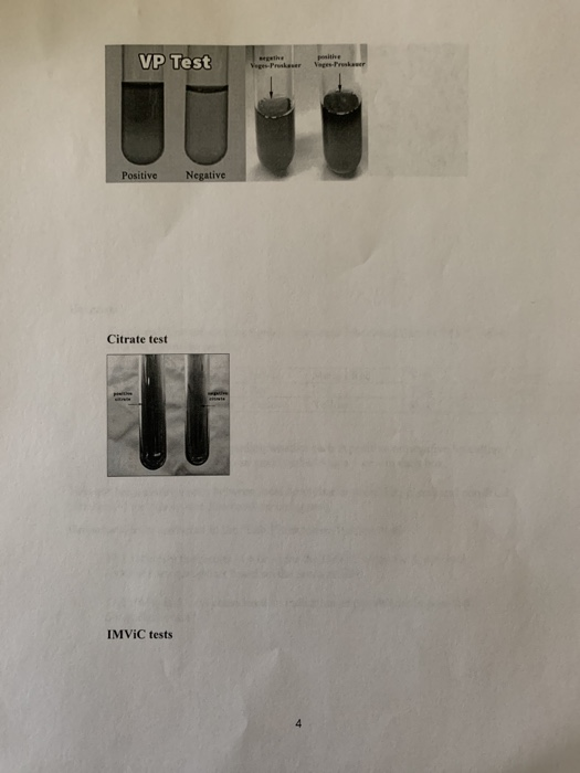 Solved . Lab # 17: IMVIC The IMViC is a series of four tests | Chegg.com