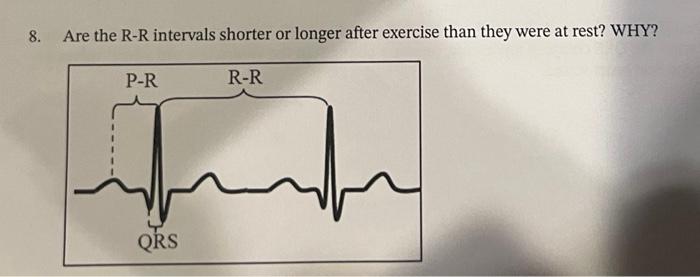 Solved 8. Are the R-R intervals shorter or longer after | Chegg.com