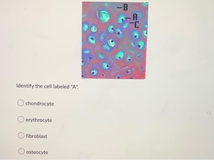 Solved Identify the cell labeled "A". chondrocyte | Chegg.com