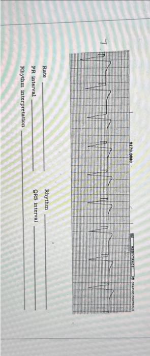 Solved Rate Rhythm PR interval QRs interval Rhythm | Chegg.com