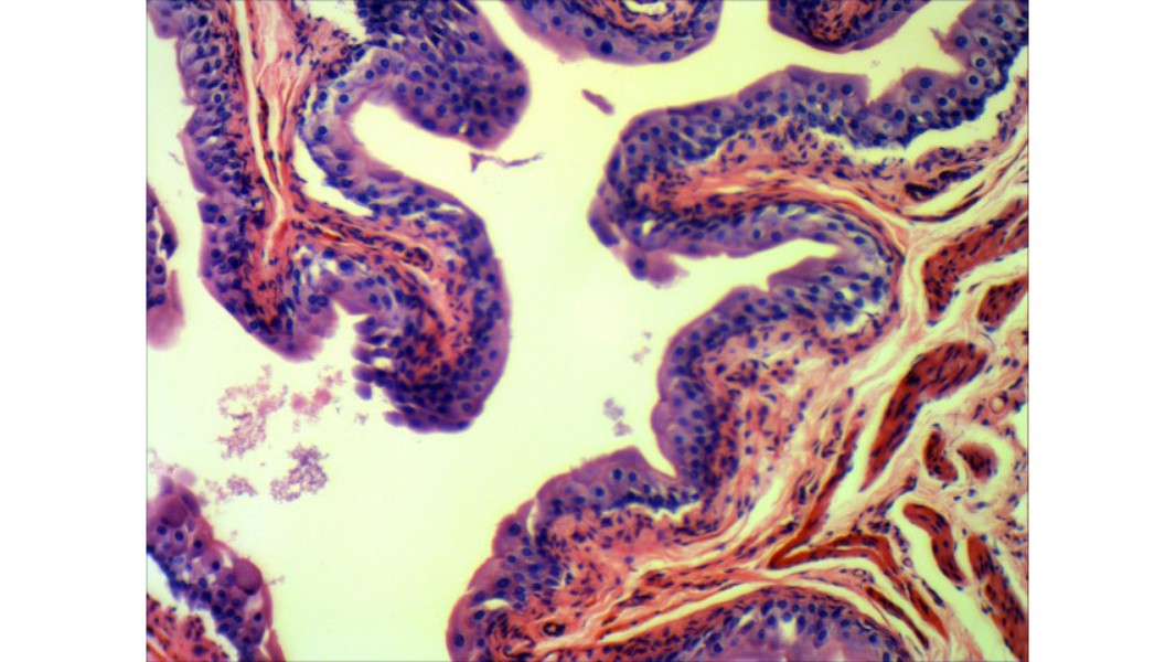 Solved I need help labeling the transitional epithelium | Chegg.com