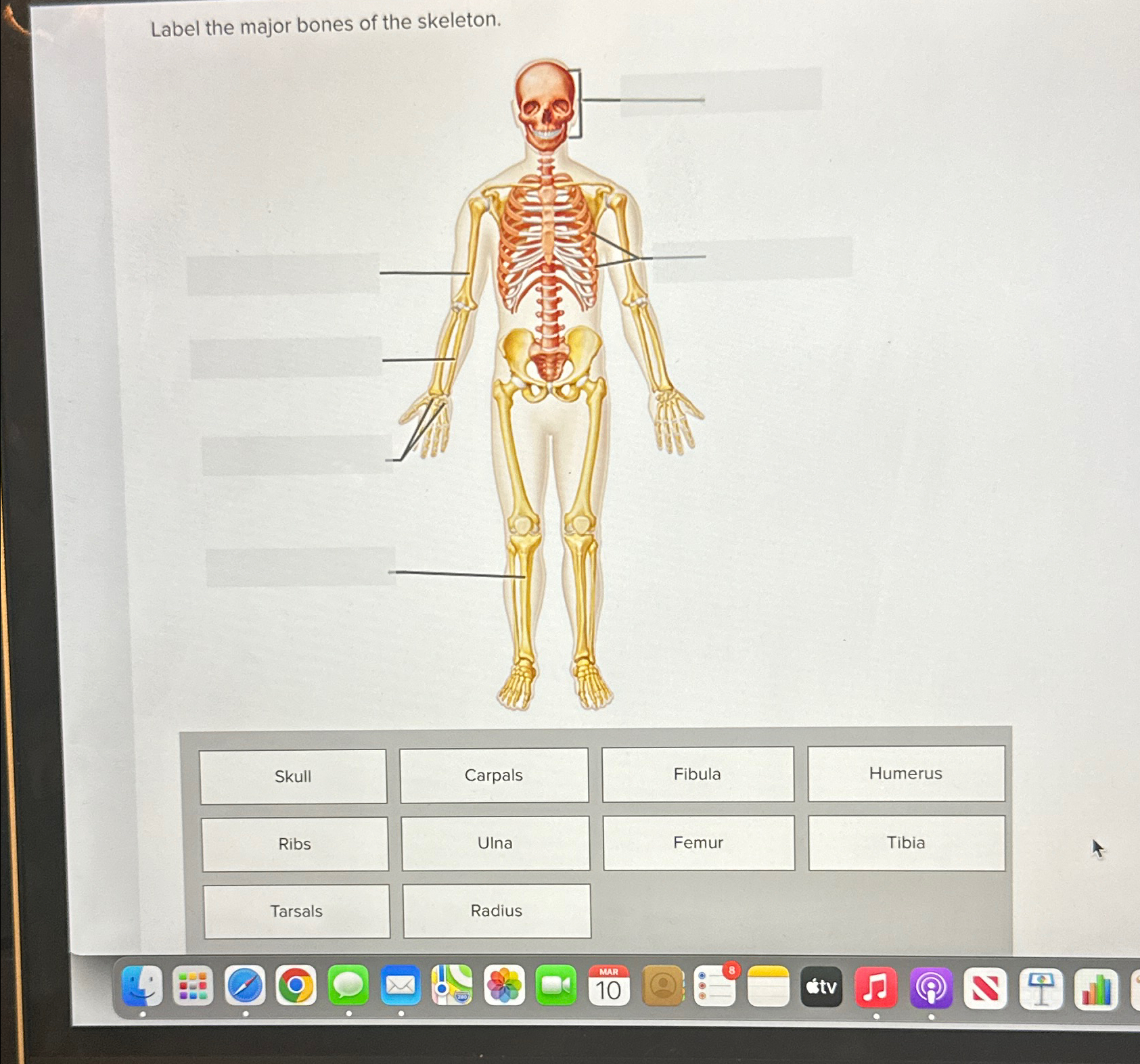 Solved Label the major bones of the skeleton. | Chegg.com
