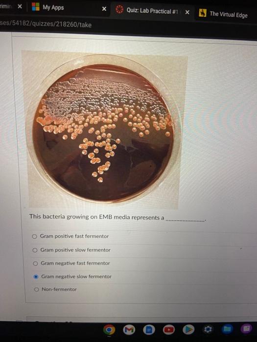 Solved This bacteria growing on EMB media represents a Gram | Chegg.com