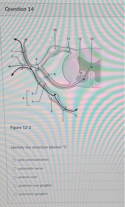 Solved Identify the structure labeled " 2 ." anterior ramus | Chegg.com