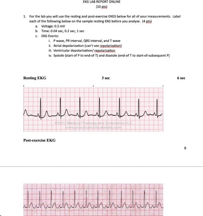 EKG LAB REPORT ONLINE (10 pts) 1. For the lab you | Chegg.com