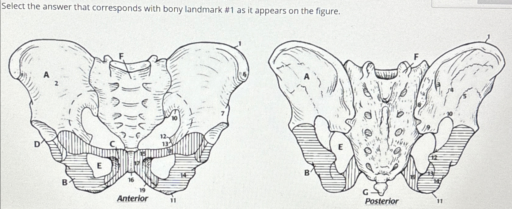 Solved Select the answer that corresponds with bony landmark | Chegg.com
