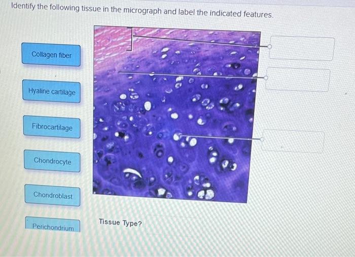 Solved Identify the following tissue in the micrograph and | Chegg.com
