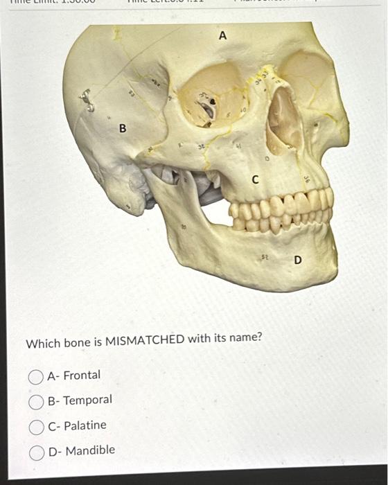 Solved Which bone is MISMATCHED with its name? A- Frontal B- | Chegg.com