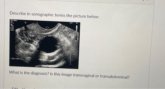 Describe In Sonographic Terms The Picture Below What