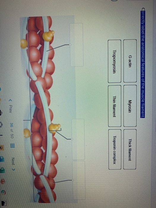 Solved Correctly label the anatomical features of the muscle | Chegg.com