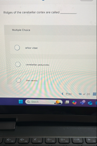 Solved Ridges of the cerebellar cortex are called Multiple | Chegg.com