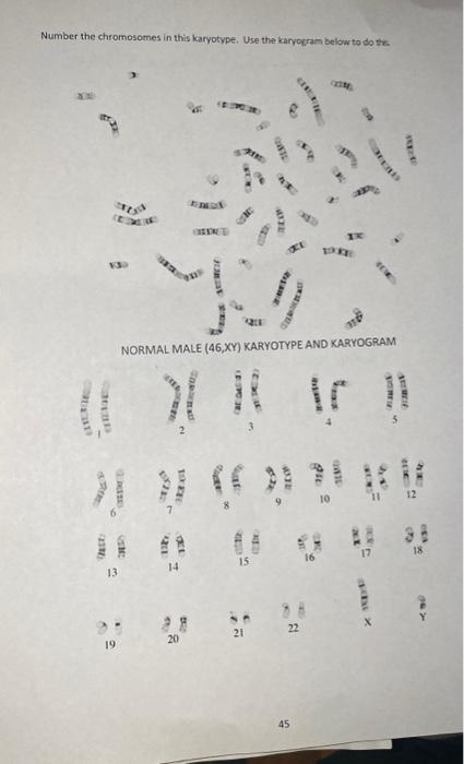 NORIMAL KARYOTYPES Number the chromosomes in this | Chegg.com