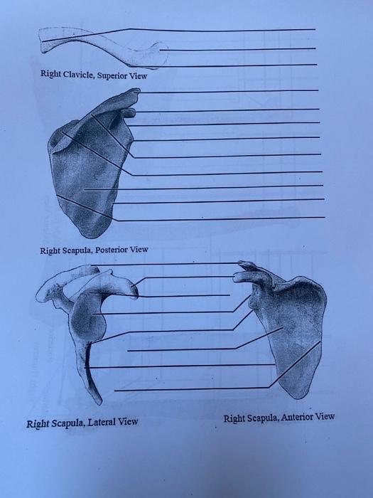 Solved Atlas, Superior View Axis. Posterior Superior View | Chegg.com
