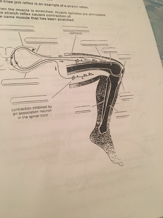 Solved e knee jerk reflex is an example of a stretch reflex | Chegg.com