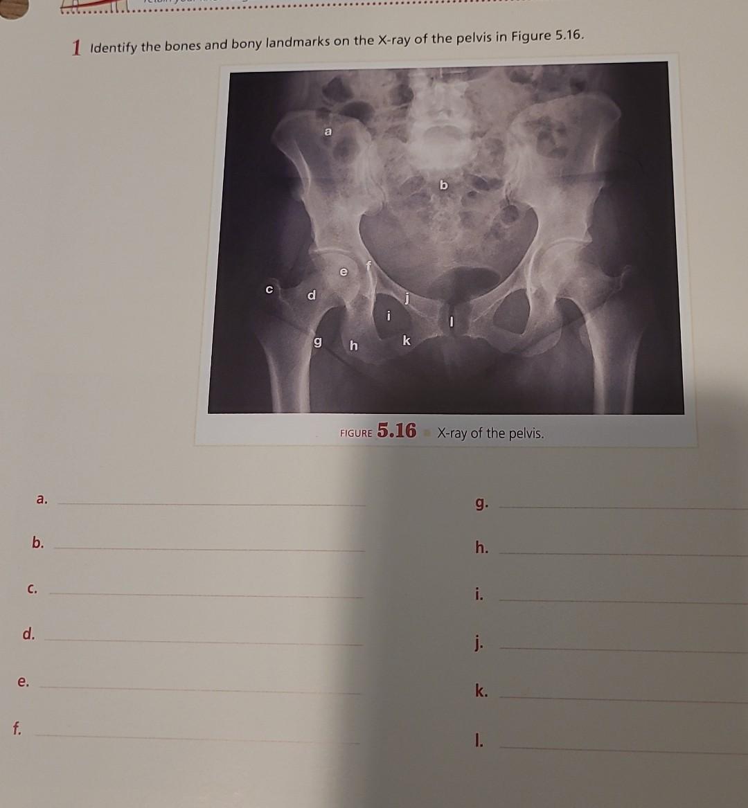 Solved Identify the bones and bony landmarks on the X-ray of | Chegg.com