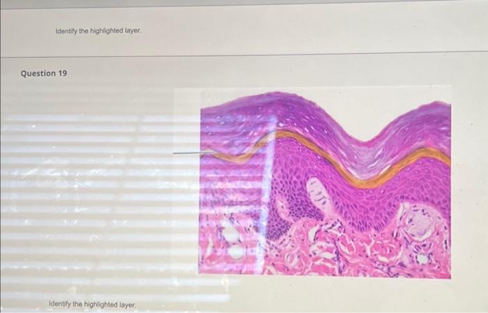 Identify the highlighted layer. | Chegg.com