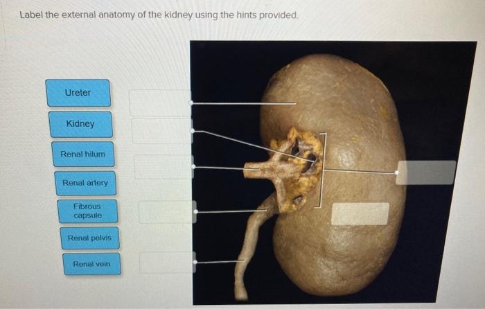 Label the external anatomy of the kidney using the | Chegg.com
