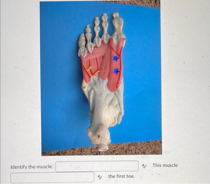 [Solved]: Identify the muscle. A/ the first toe. A This mus