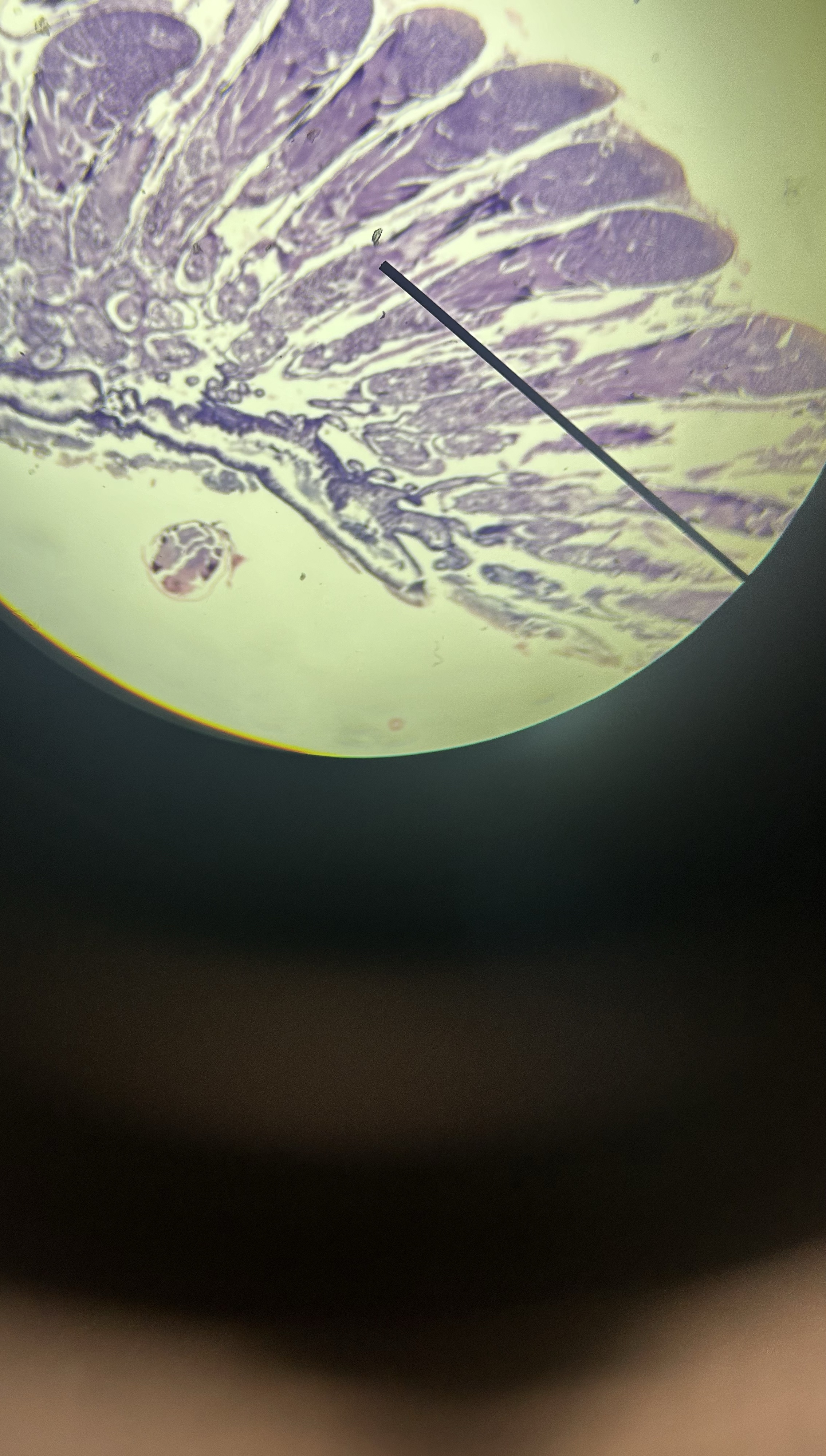 Label the following on Grasshopper Testis Testicular | Chegg.com
