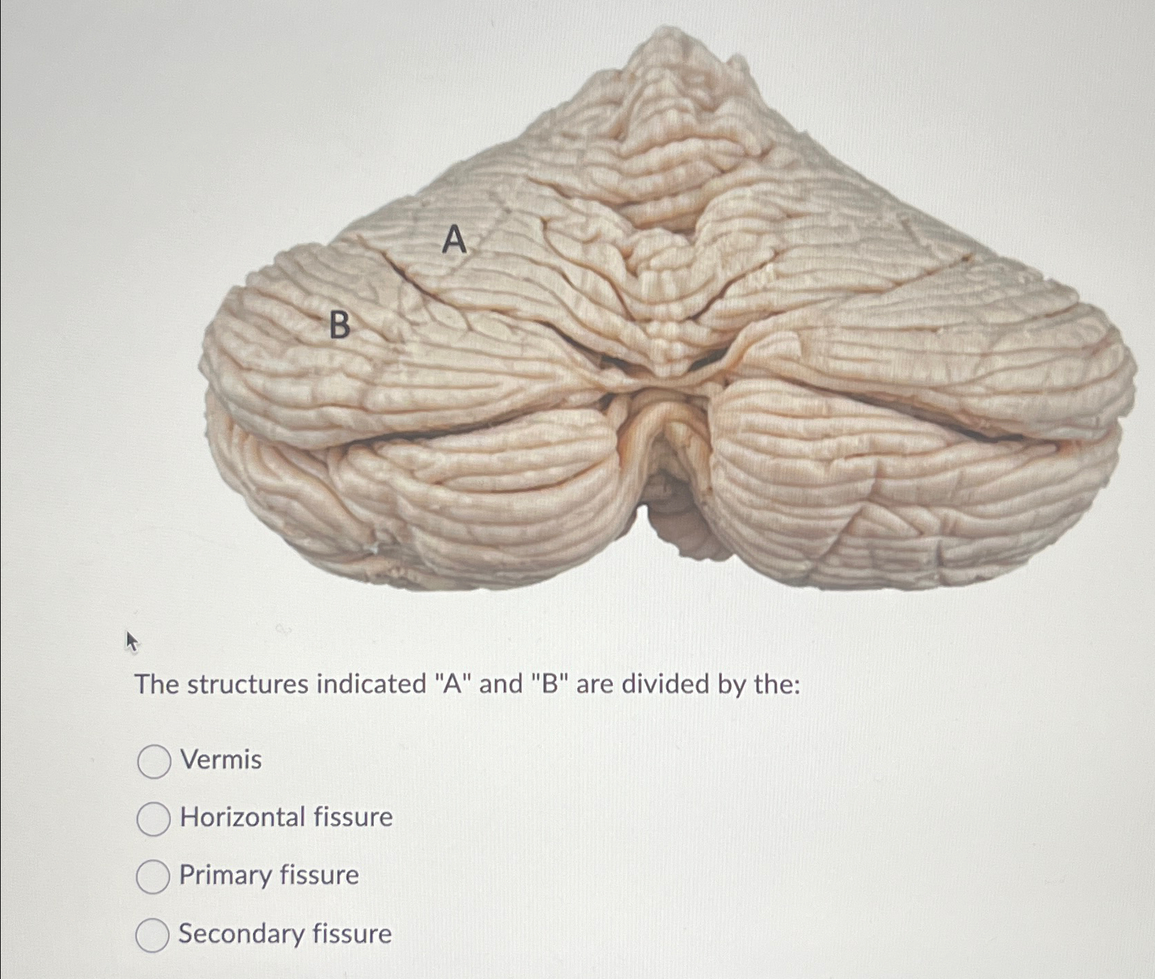 Solved The structures indicated "A" ﻿and "B" ﻿are divided by | Chegg.com