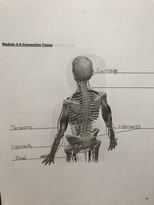 Solved Module 4.6 Connective Tissue • Cartilage Tendons | Chegg.com