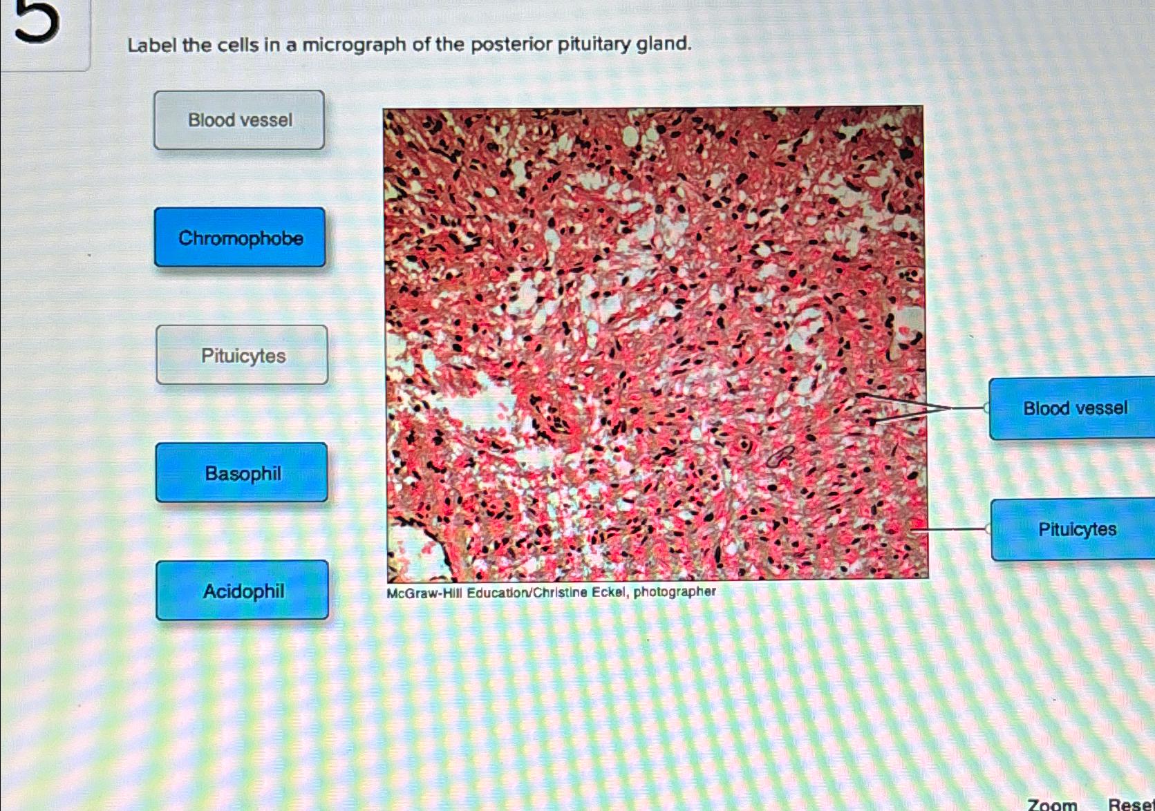 Solved Label the cells in a micrograph of the posterior | Chegg.com