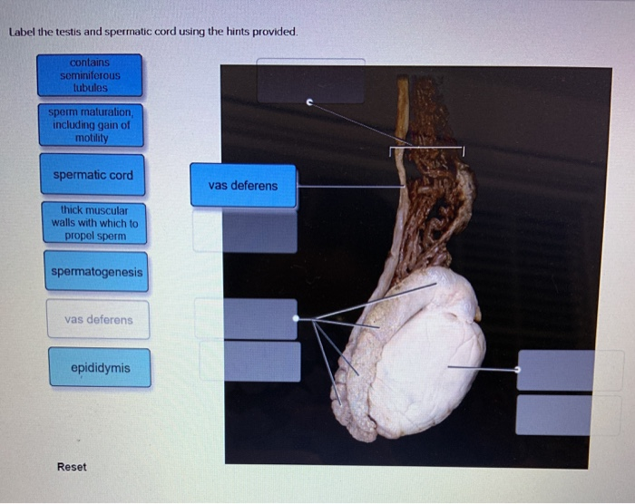 Solved Label The Testis And Spermatic Cord Using The - vrogue.co Solved Label The Testis And Spermatic Cord Using The - vrogue.co