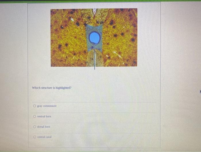 Solved Which structure is highlighted? gray commissure | Chegg.com