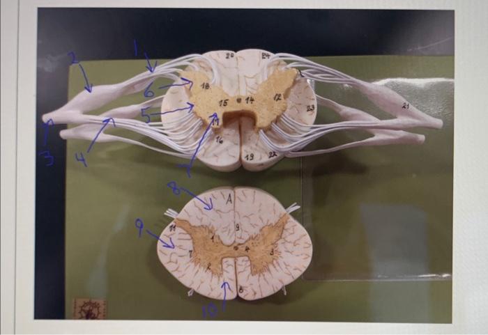 Solved posterior horn posterior (sensory) root posterior | Chegg.com
