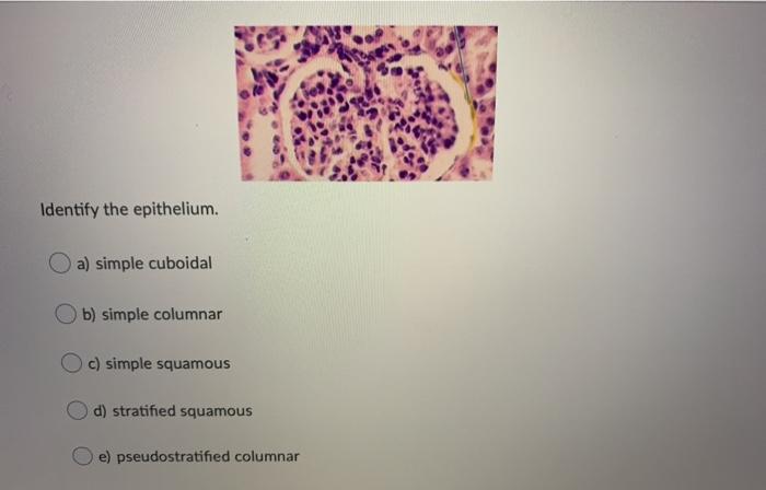 Solved Identify the epithelium. a) simple cuboidal b) simple | Chegg.com
