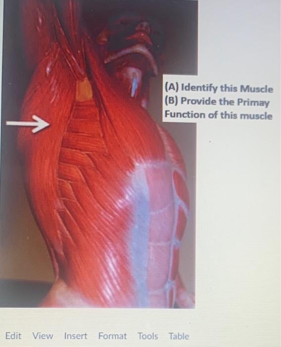 Solved (1) Identify the structure indicated by the arrow | Chegg.com