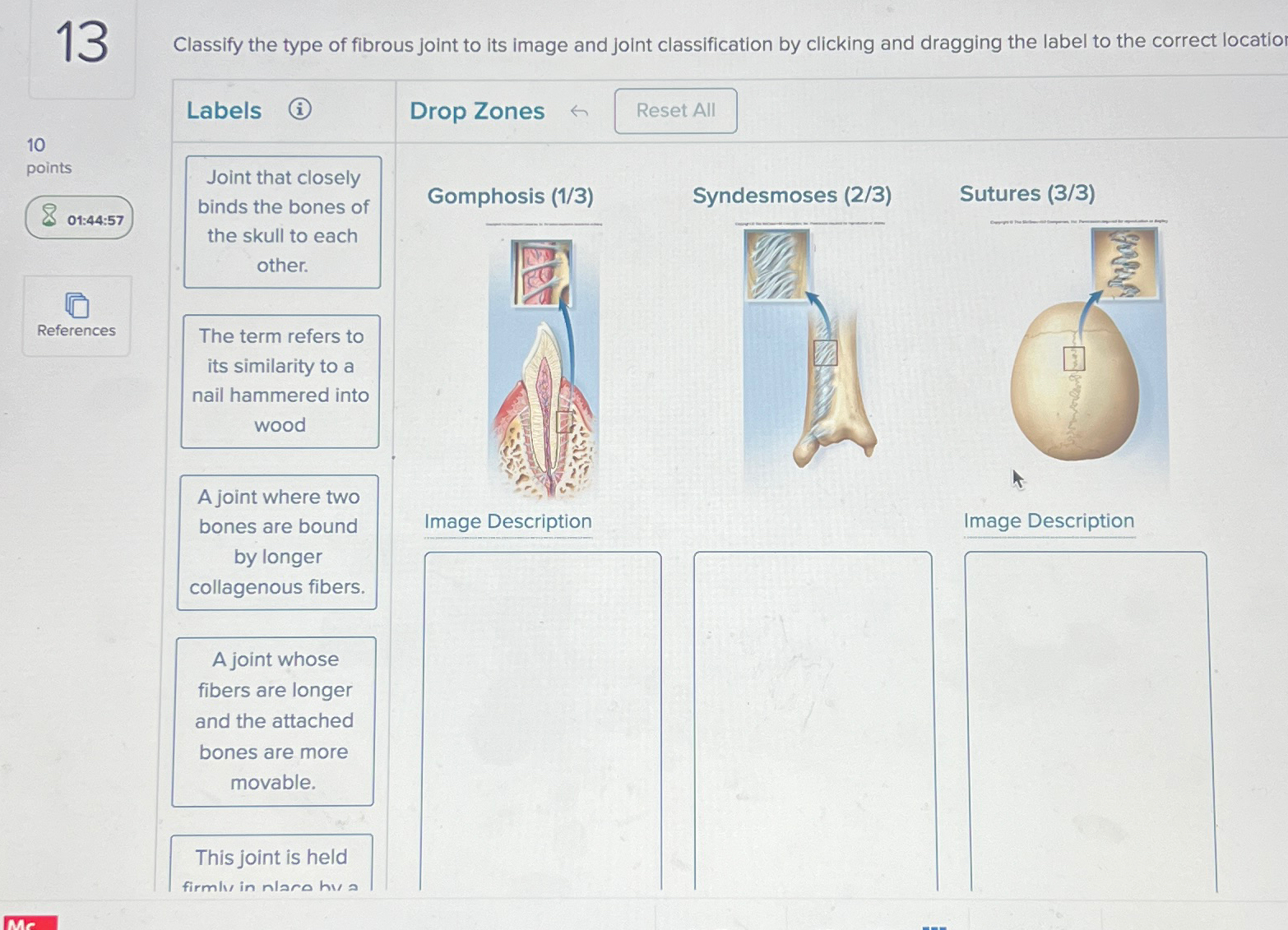 Solved 13Classify the type of fibrous joint to its image and | Chegg.com