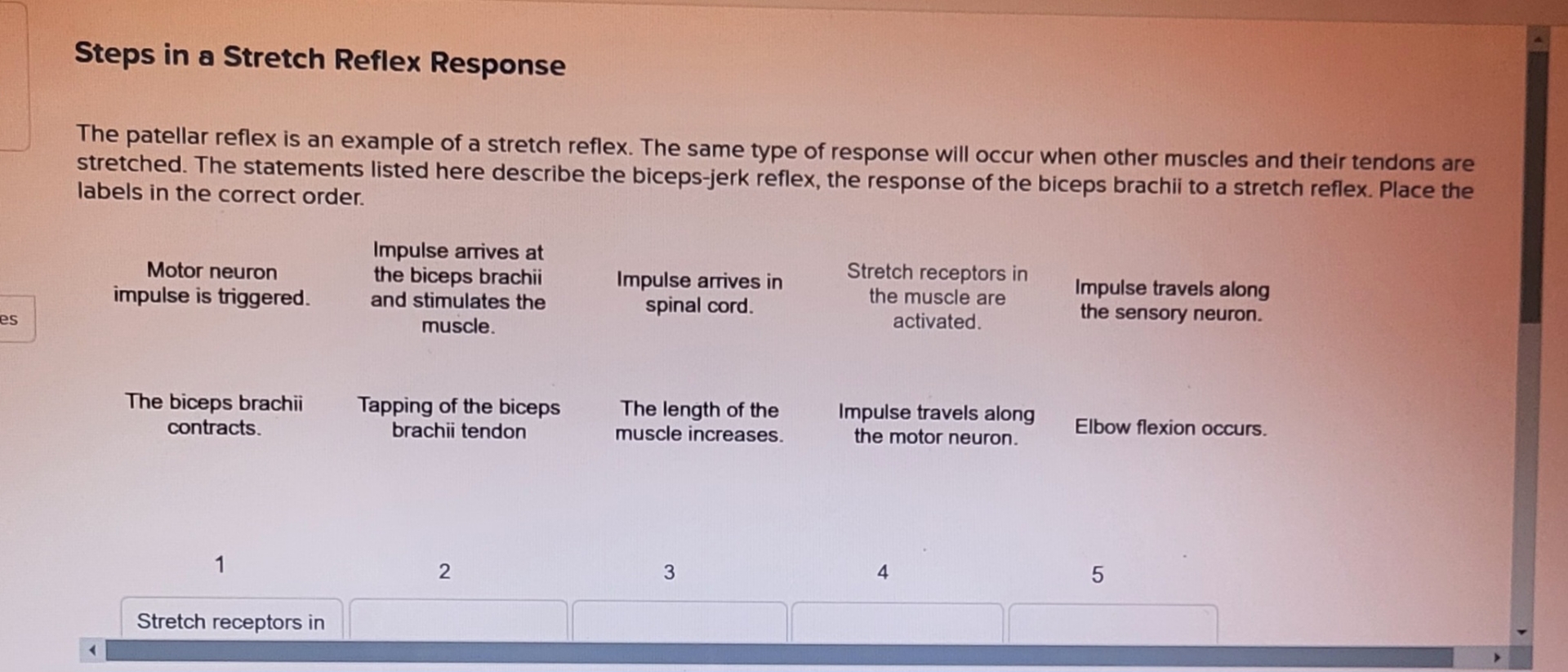 Solved Steps in a Stretch Reflex ResponseThe patellar reflex | Chegg.com