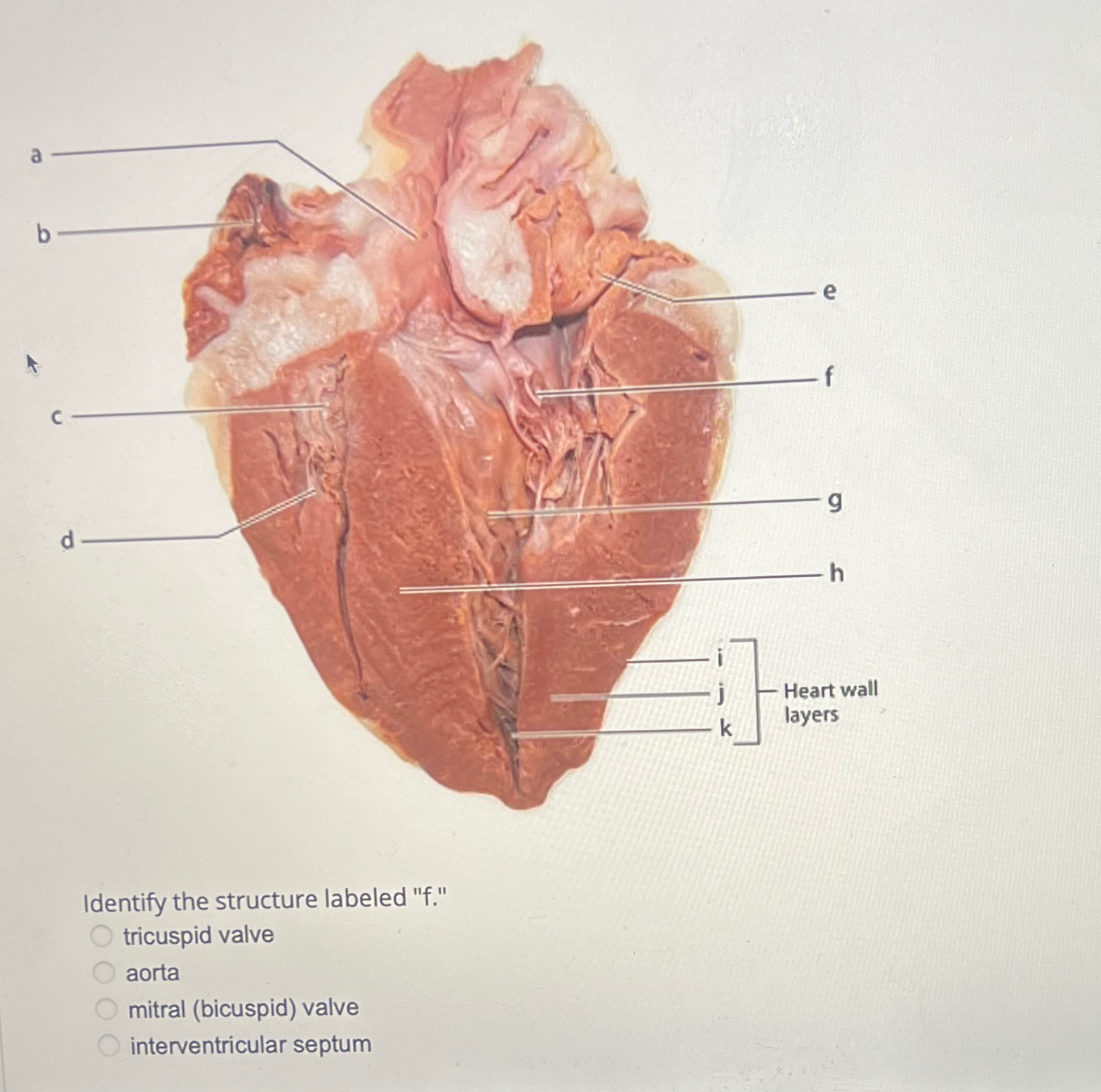 Solved Identify the structure labeled "f."tricuspid | Chegg.com
