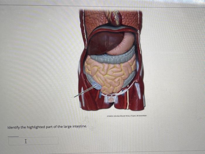 Solved Identify the highlighted part of the large intestine. | Chegg.com