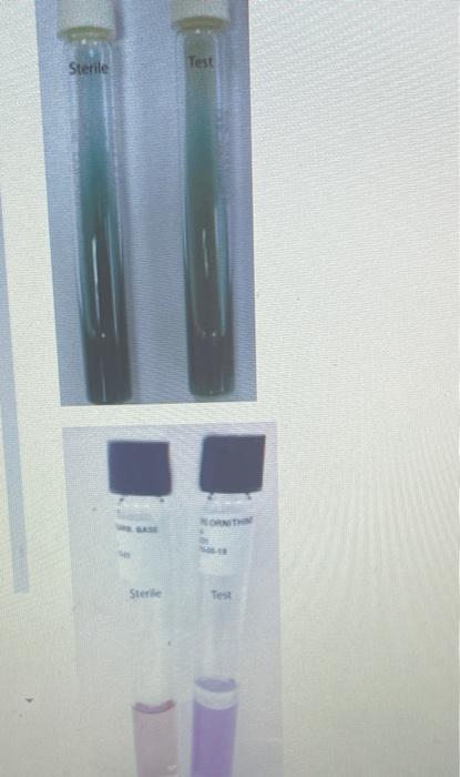 Solved the following media and biochemical results, identify | Chegg.com