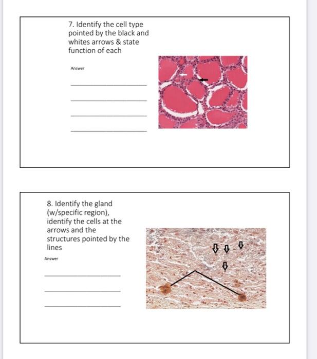 Solved 7. Identify the cell type pointed by the black and | Chegg.com