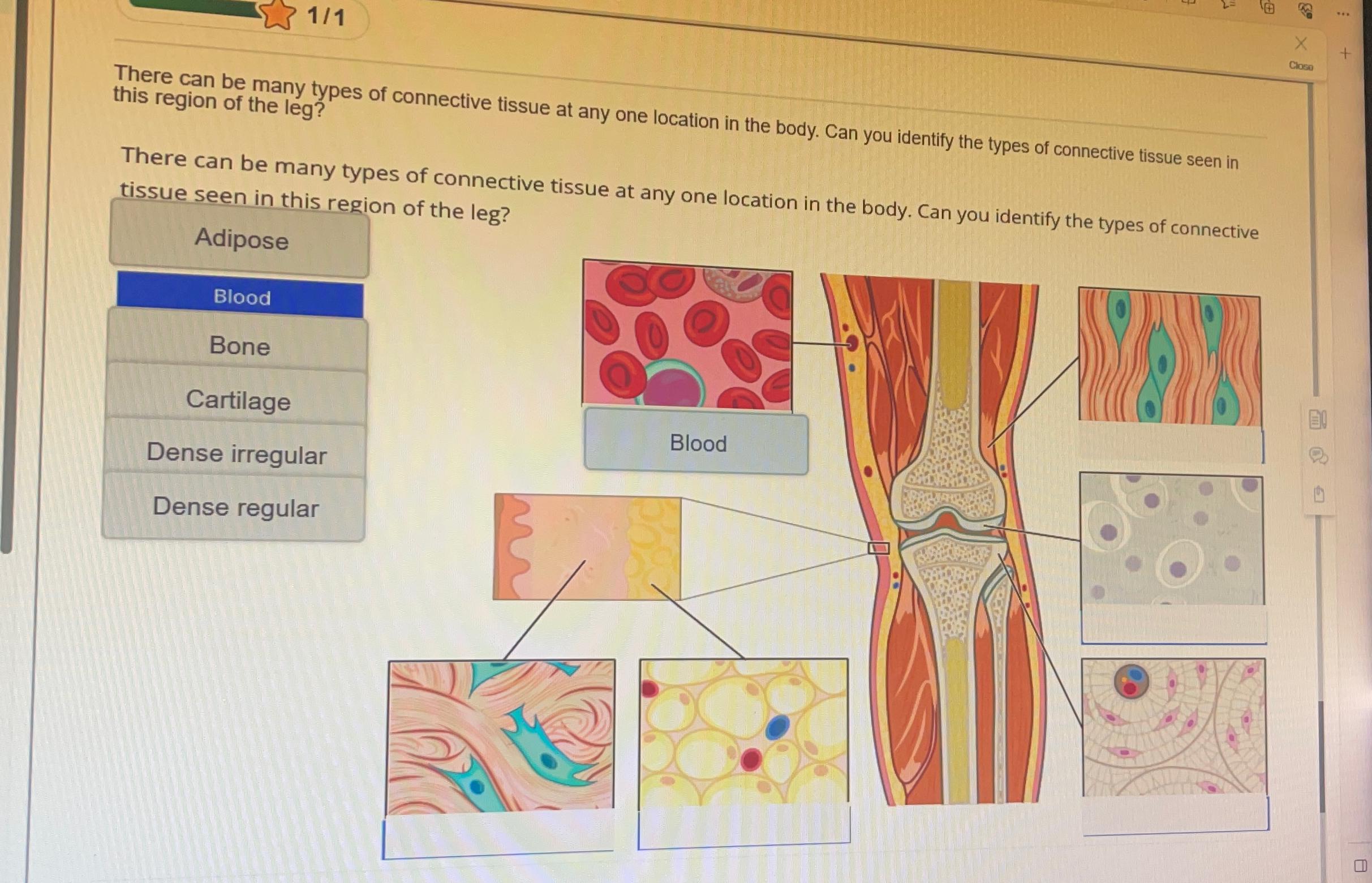 Solved 11There can be many types of connective tissue at any | Chegg.com