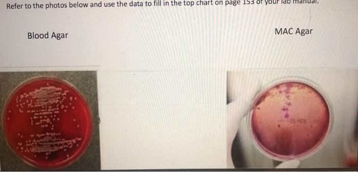 Solved Urine Culture MAC Plate Blood Agar Plate Number of | Chegg.com