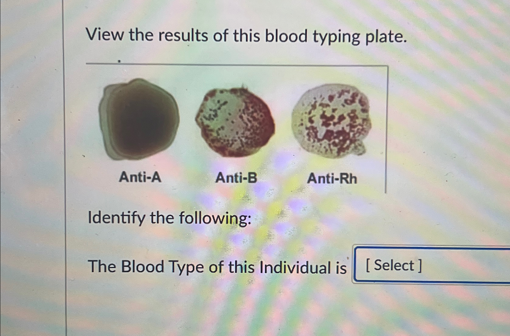 Solved View the results of this blood typing | Chegg.com